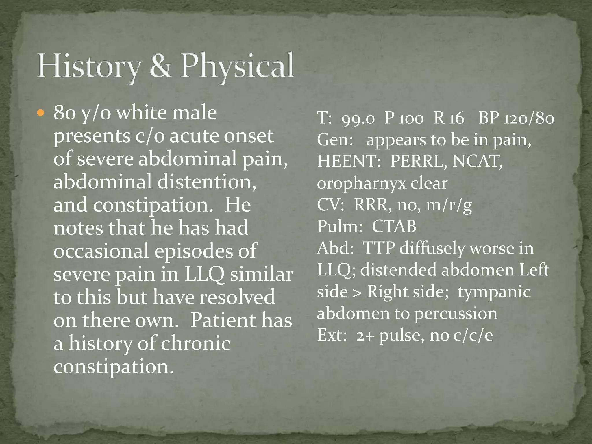 Sigmoid volvulus Power Point | PPTX