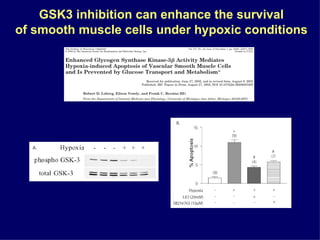 Signaling events triggered by inactivation of the TSC1-2 Complex ...