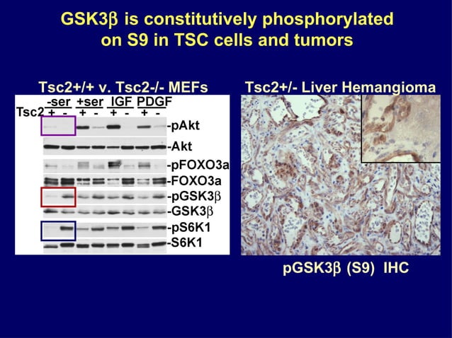 Signaling events triggered by inactivation of the TSC1-2 Complex ...