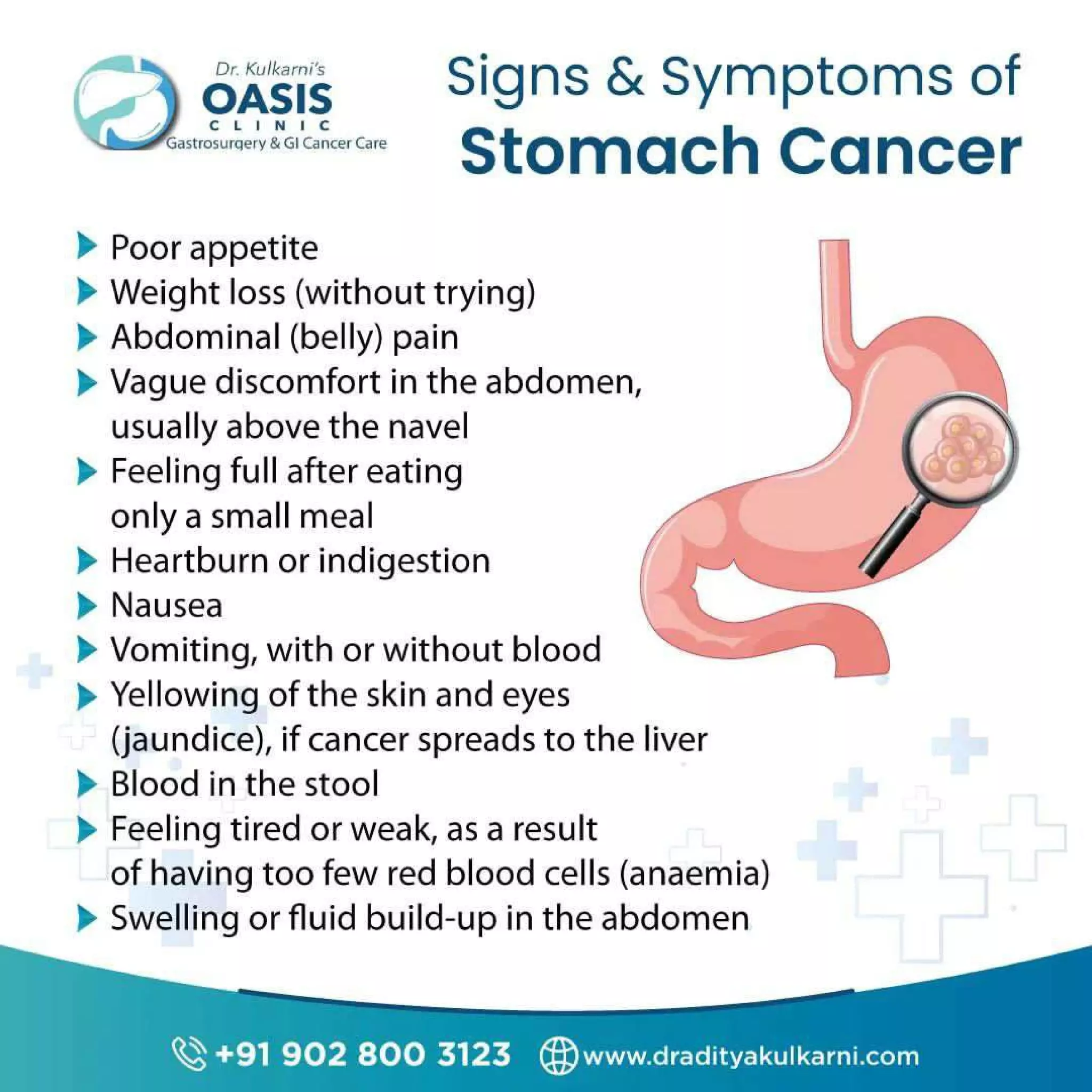 Sign and Symptoms of Stomach Cancer | PDF