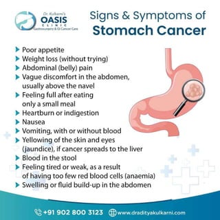 Sign and Symptoms of Stomach Cancer | PDF