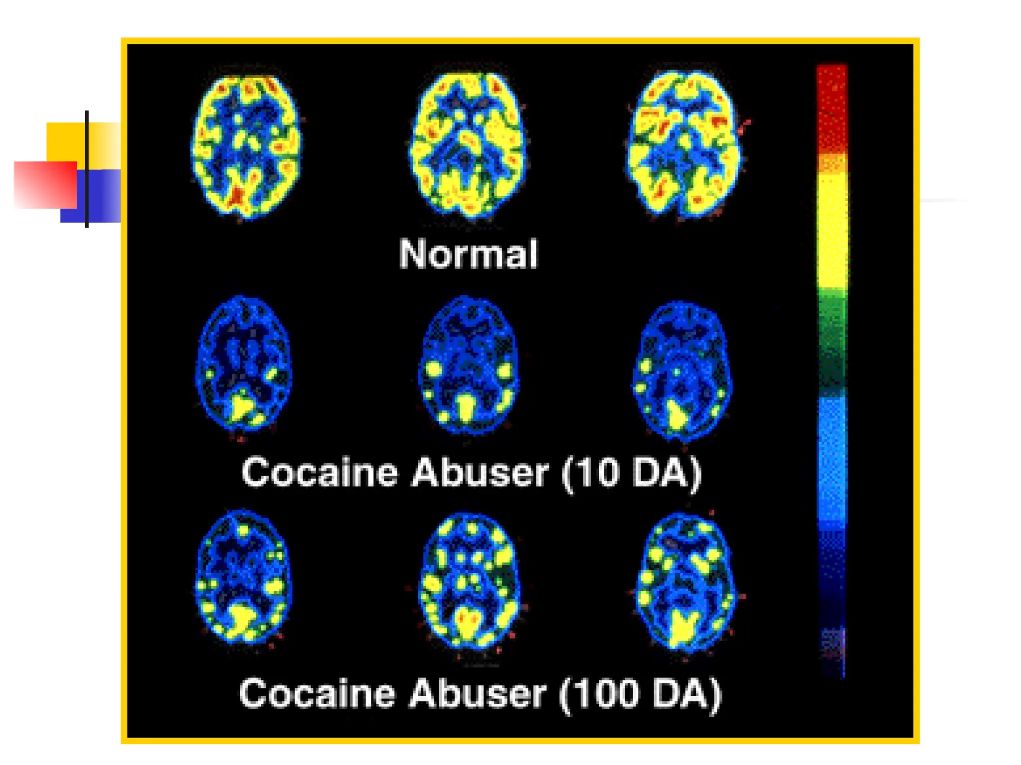 SIGN AND SYMPTOMS OF DRUG ABUSE IN HUMANS.ppt