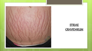 signandsymptomsofpregnancy-180203114930.pptx