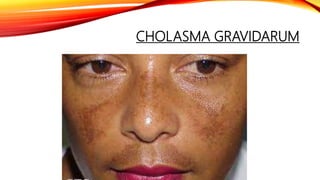 Sign and symptoms of pregnancy | PPTX