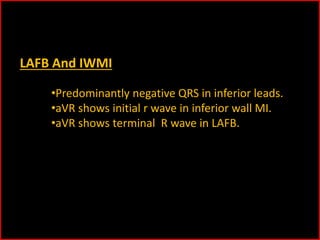 Significance of avR lead | PPT