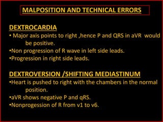 Significance of avR lead | PPT