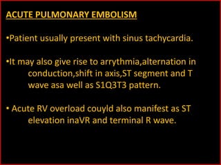 Significance of avR lead | PPT