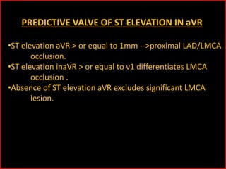 Significance of avR lead | PPT