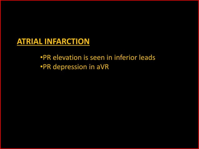 Significance of avR lead | PPT