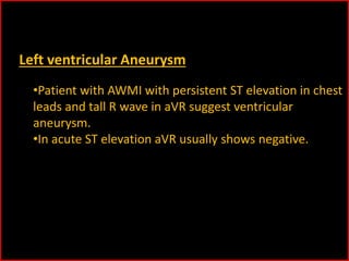 Significance of avR lead | PPT