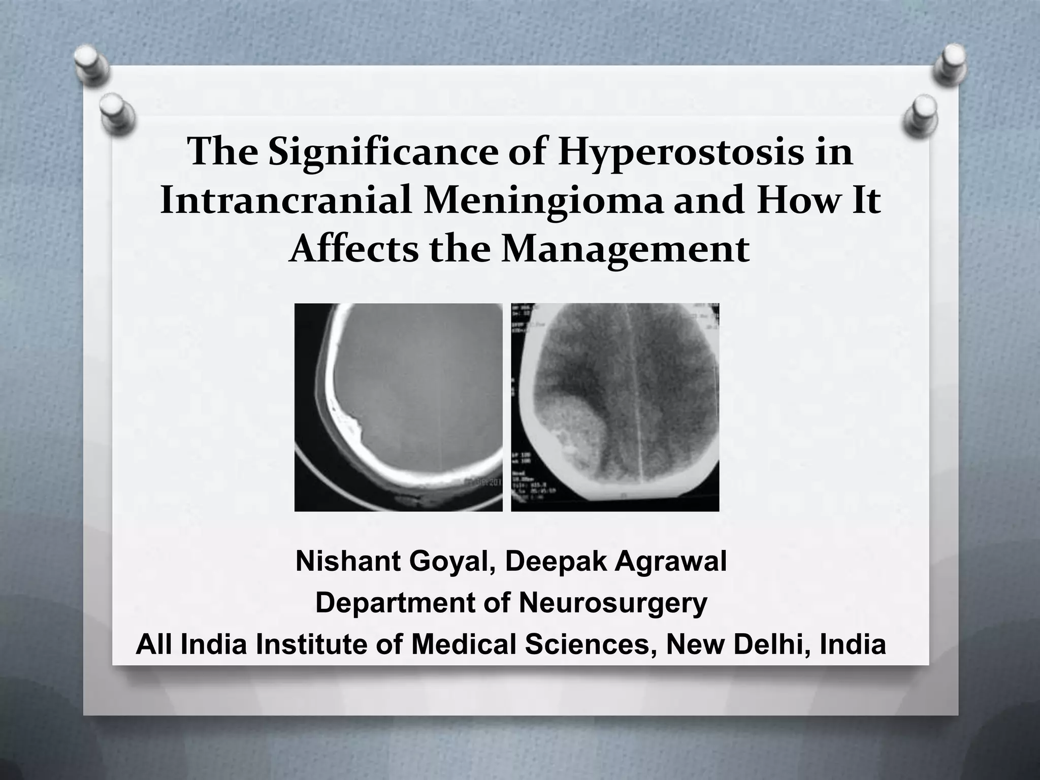 Significance of hyperostosis in meningiomas | PPTX