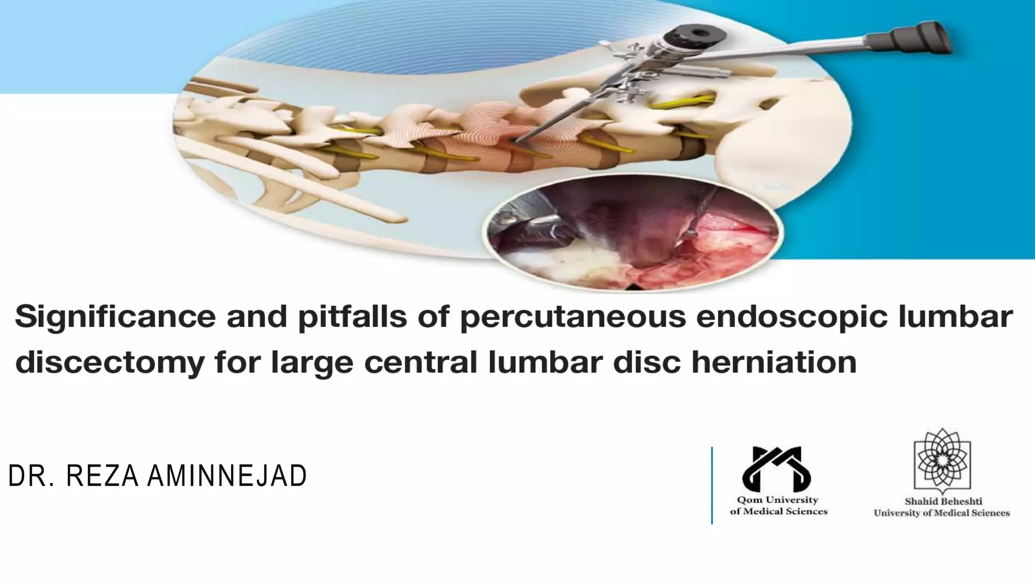 PELD-Significance and Pitfalls | PPT