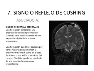 Signo o reflejo de cushing | PPT