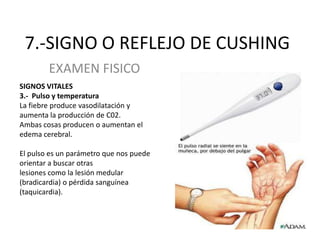 Signo o reflejo de cushing | PPT