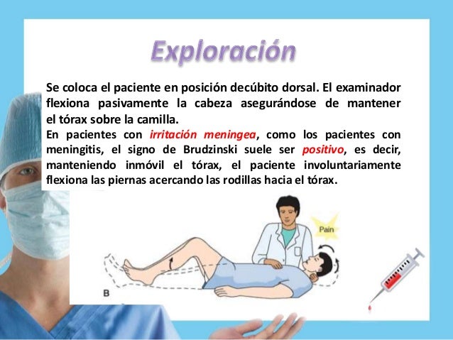 Signo de Brudzinski y de Kerning - Elyz A. Cortez López