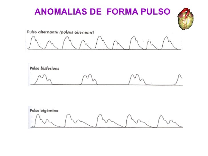 Signos Cardiovasculares