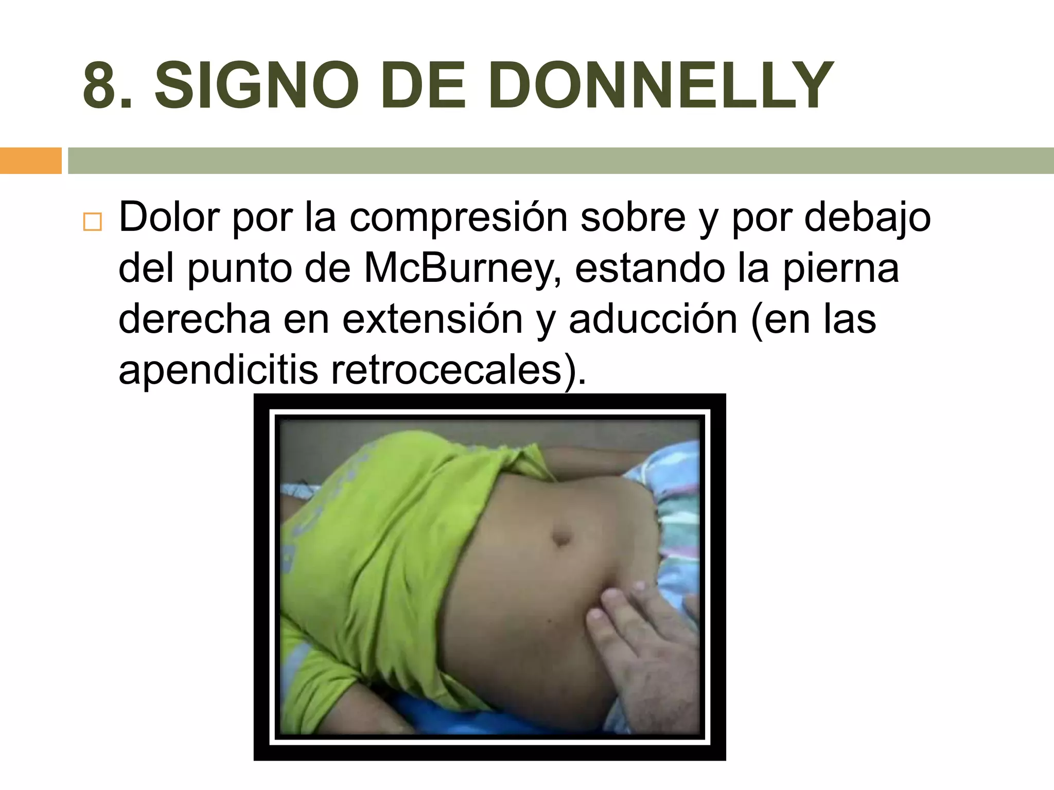 Signos clinicos de apendicitis | PPTX