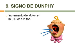 Signos clinicos de apendicitis | PPTX