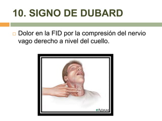 Signos clinicos de apendicitis | PPTX