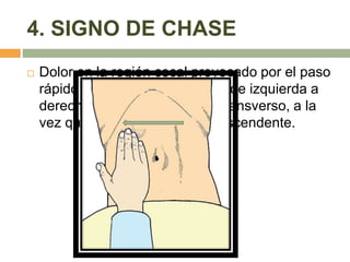 Signos clinicos de apendicitis | PPT