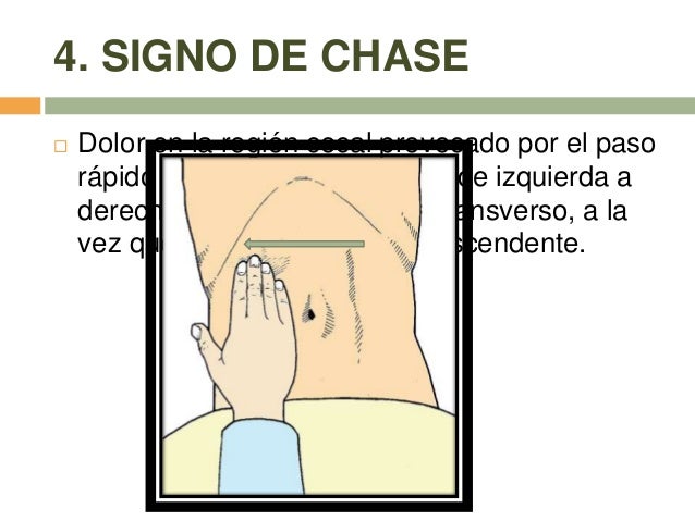 Signos clinicos de apendicitis