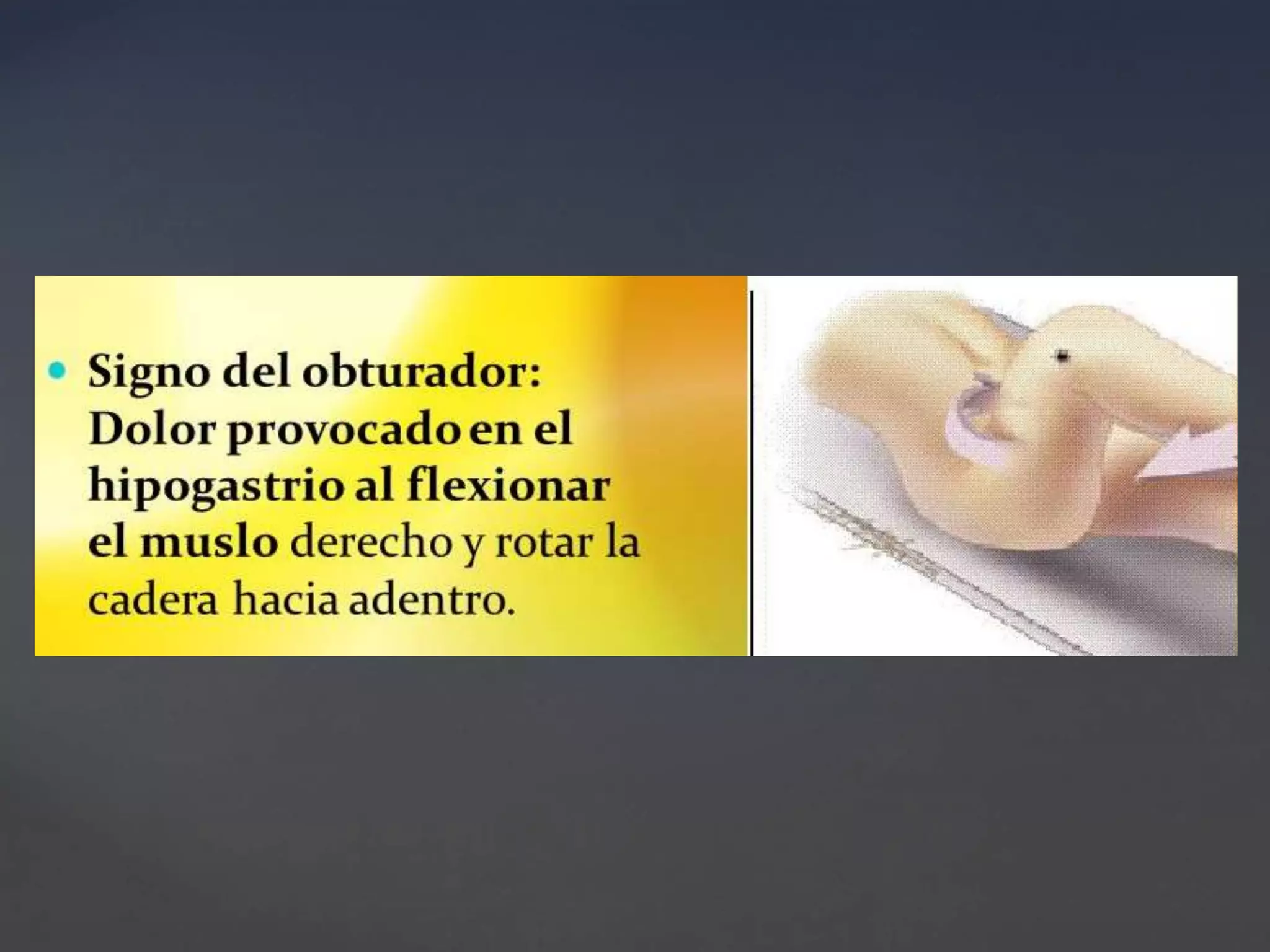 Signos de abdomen | PPTX