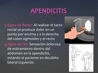 Signos de abdomen | PPTX