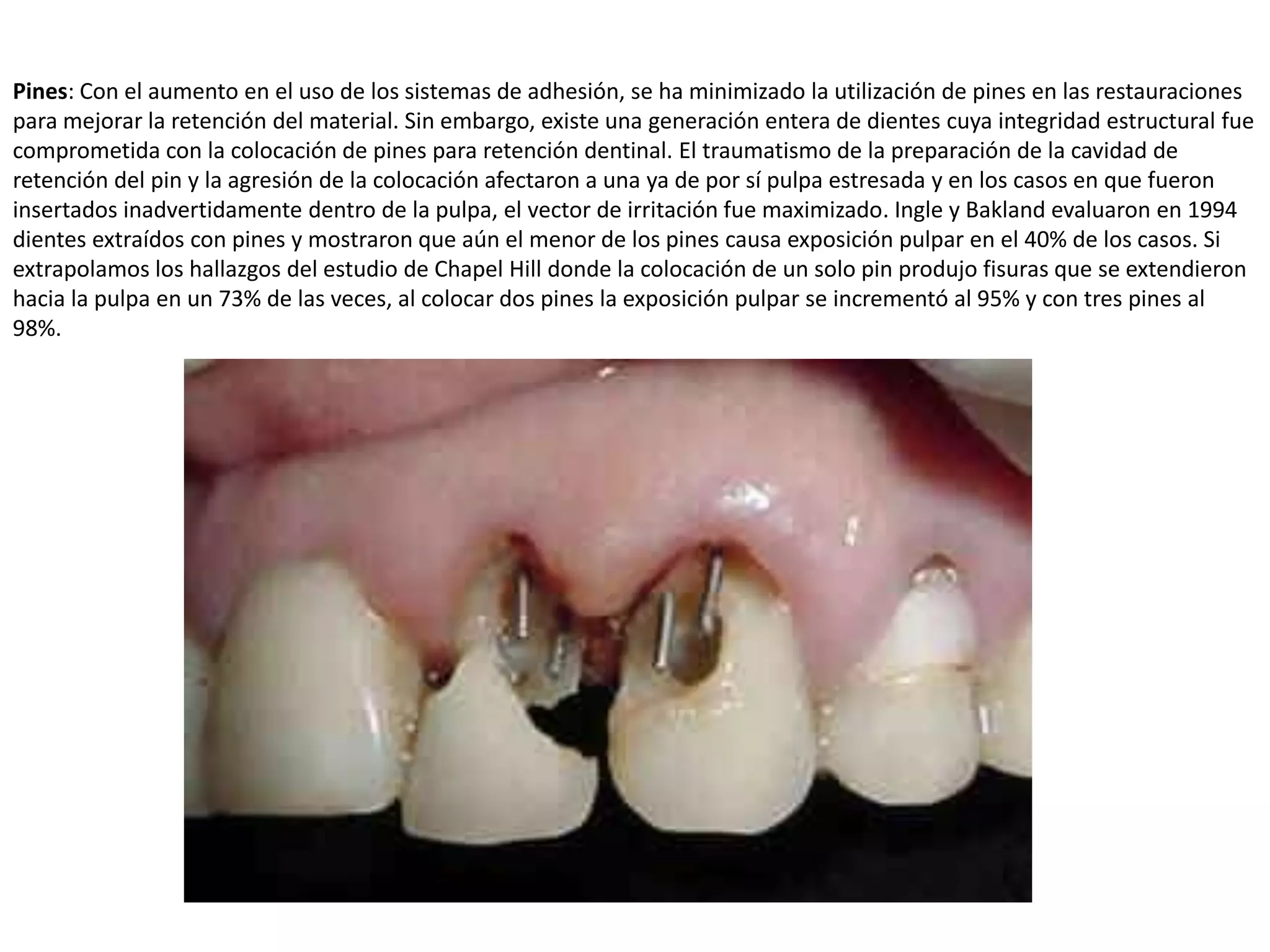 Signos de advertencia de las lesiones pulpares | PPTX