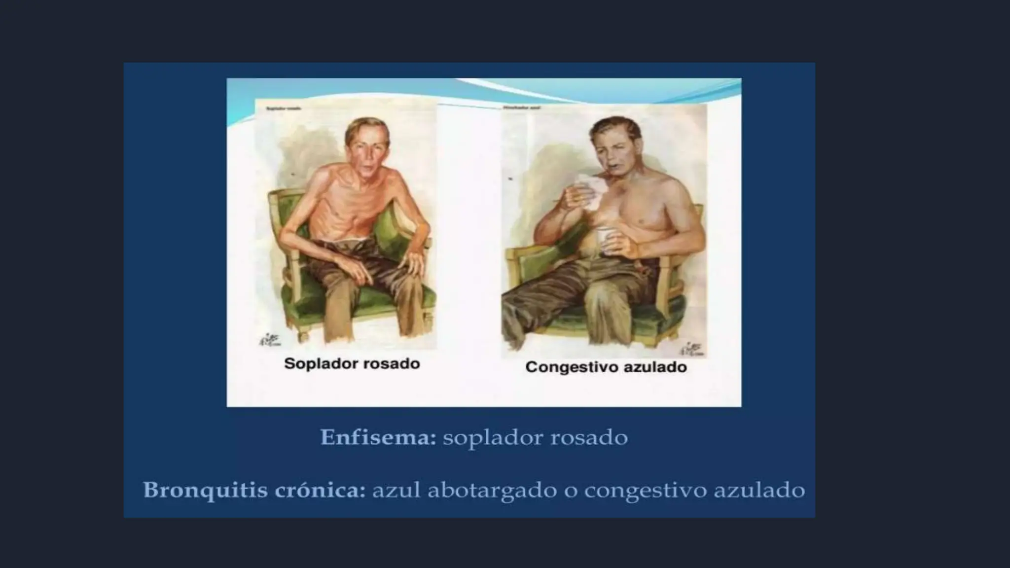 SIGNOS RADIOLOGICOS PATOLOGICOS DE TORAX.pptx