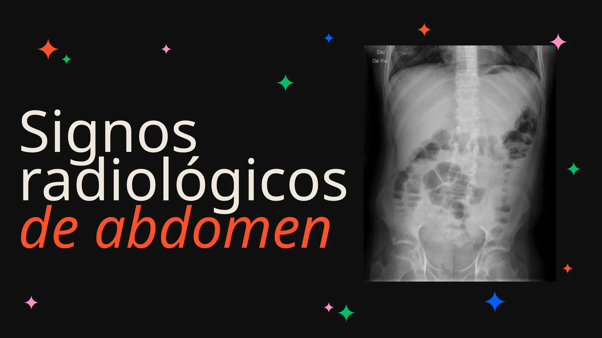 Signos radiológicos de abdomen presentación.pptx