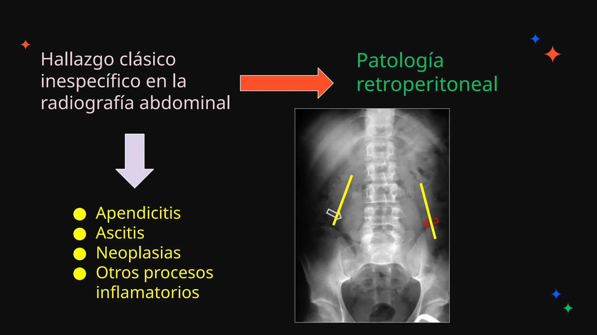 Signos radiológicos de abdomen presentación.pptx