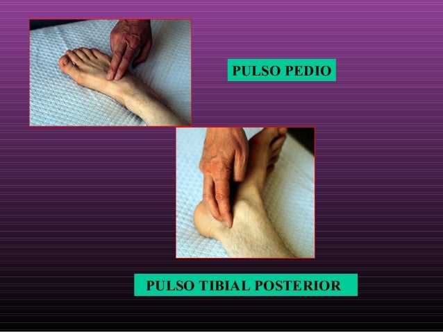 Pulso Tibial Posterior