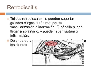 Signos y sintomas de los transtornos temporomandibulares (1) | PPTX