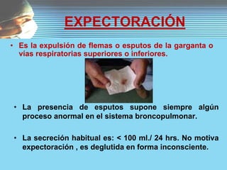 Signos y síntomas respiratorios | PPT