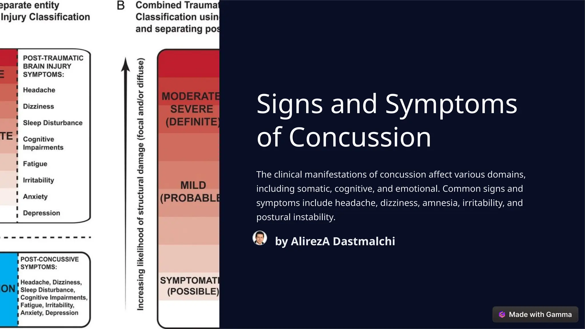 Concussion syndrom after mild traumatic brain injury in athletes .pptx