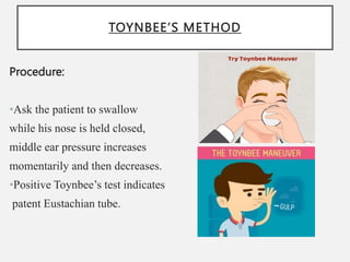 Signs and Examination of Chronic Suppurative Otitis Media | PPTX