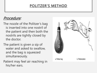 Signs and Examination of Chronic Suppurative Otitis Media | PPT