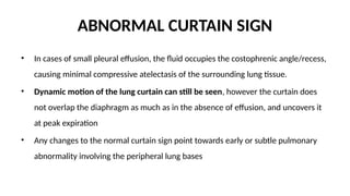 Signs and lines in usg thorax.pptx radiolgy | PPTX