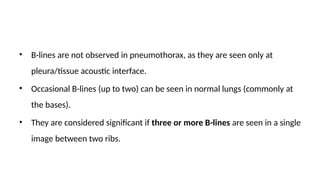 Signs and lines in usg thorax.pptx radiolgy | PPTX