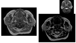 Signs and lines in usg thorax.pptx radiolgy | PPTX