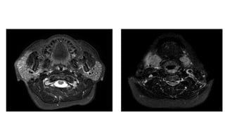 Signs and lines in usg thorax.pptx radiolgy | PPTX