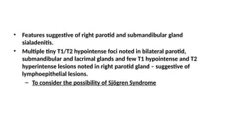 Signs and lines in usg thorax.pptx radiolgy | PPTX