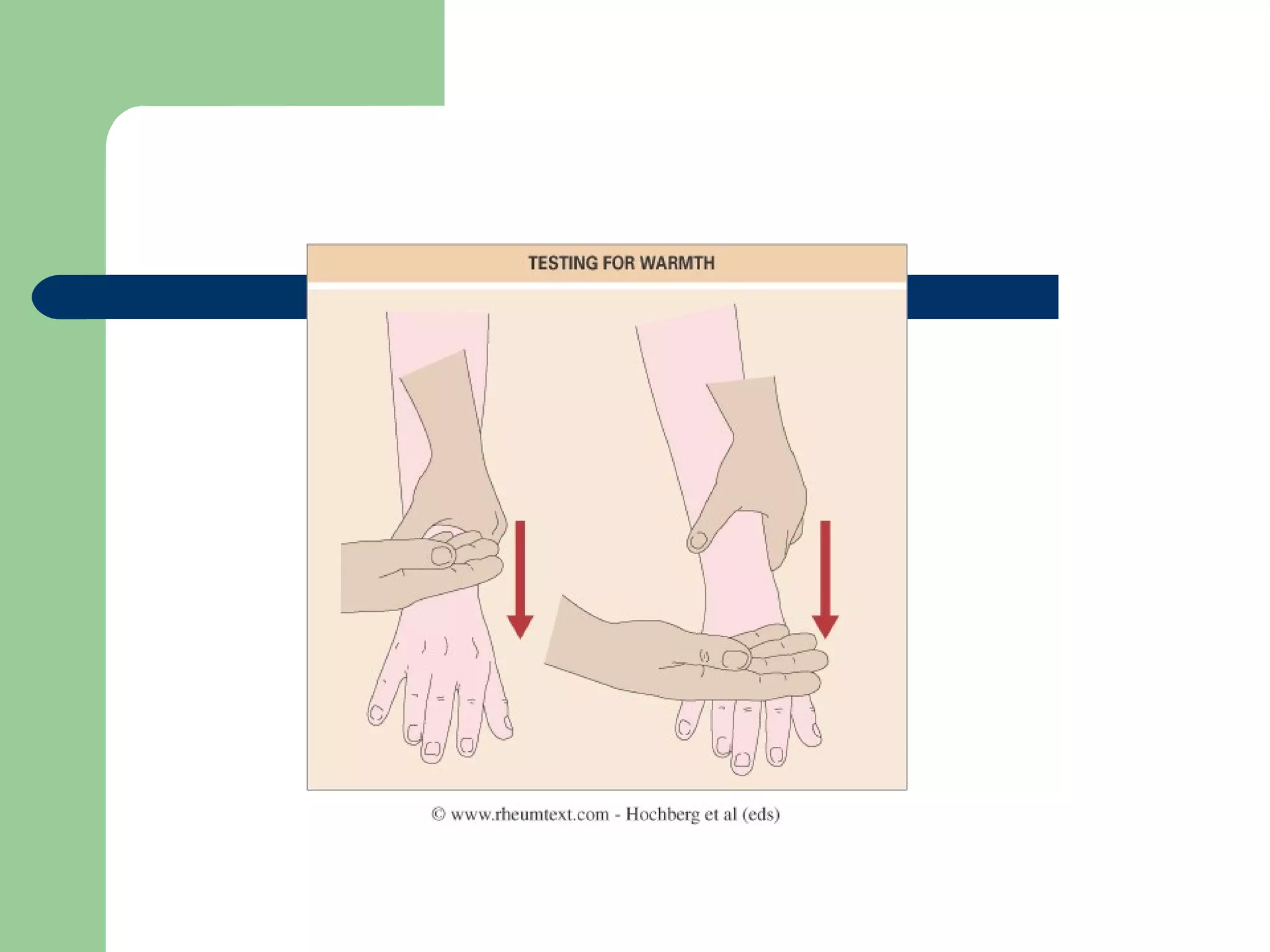 Signs and symptoms in rheumatology | PPT