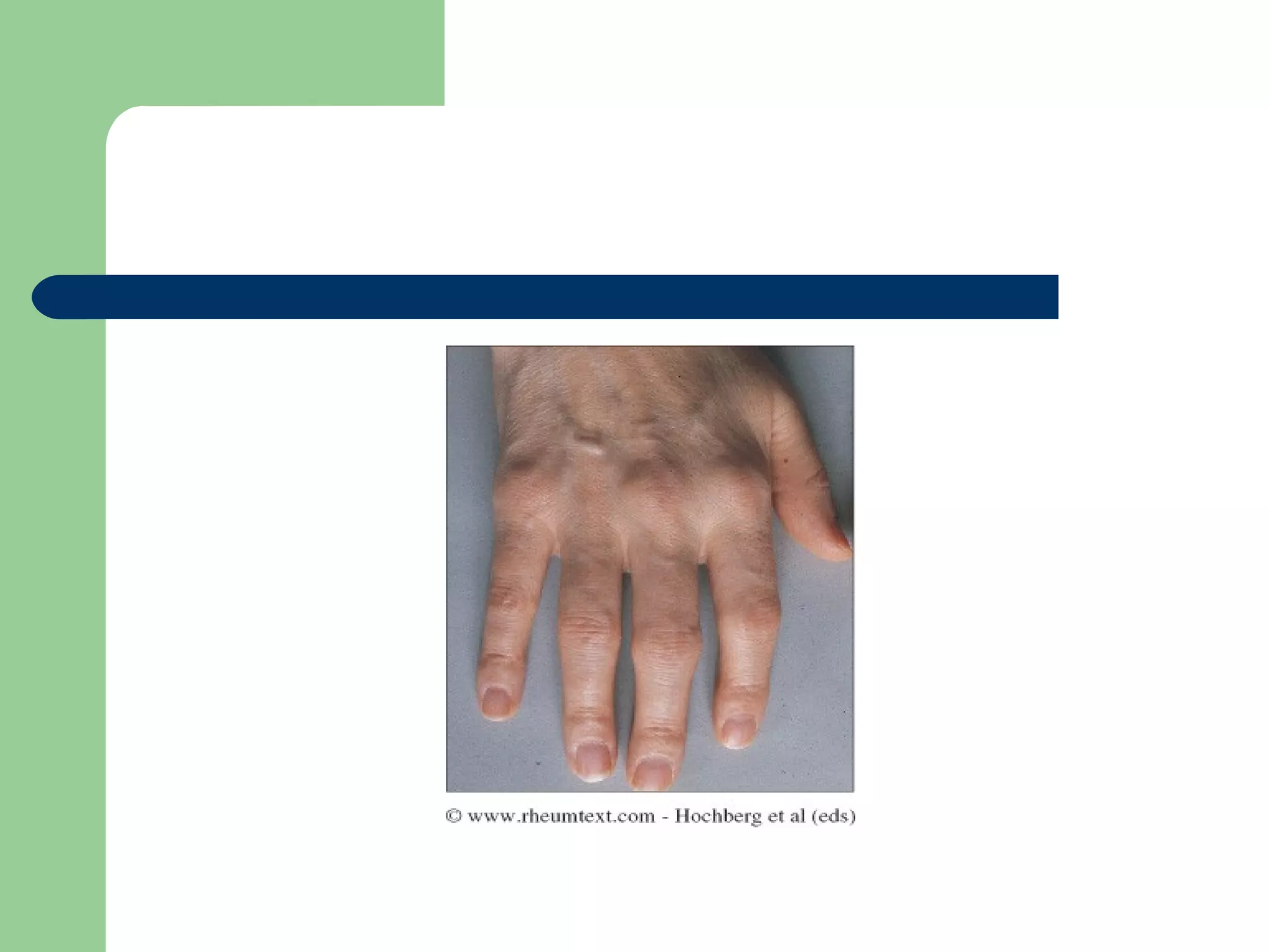 Signs and symptoms in rheumatology | PPT
