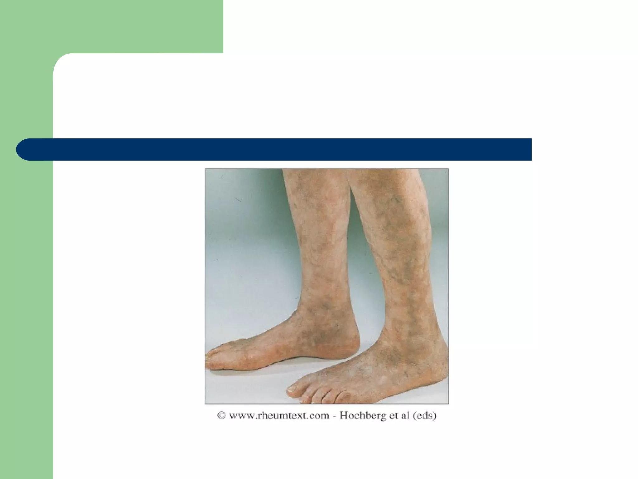 Signs and symptoms in rheumatology | PPT