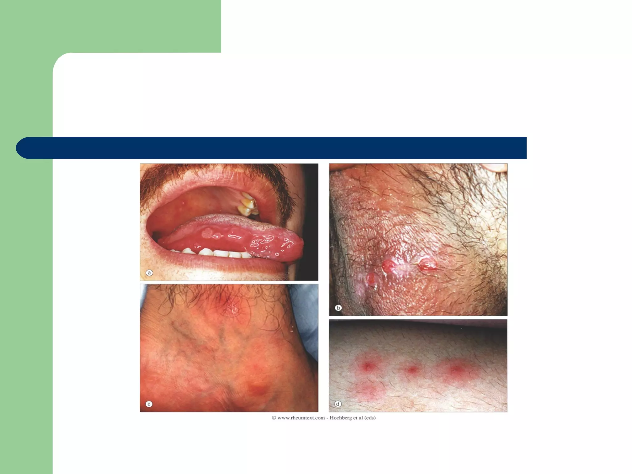 Signs and symptoms in rheumatology | PPT