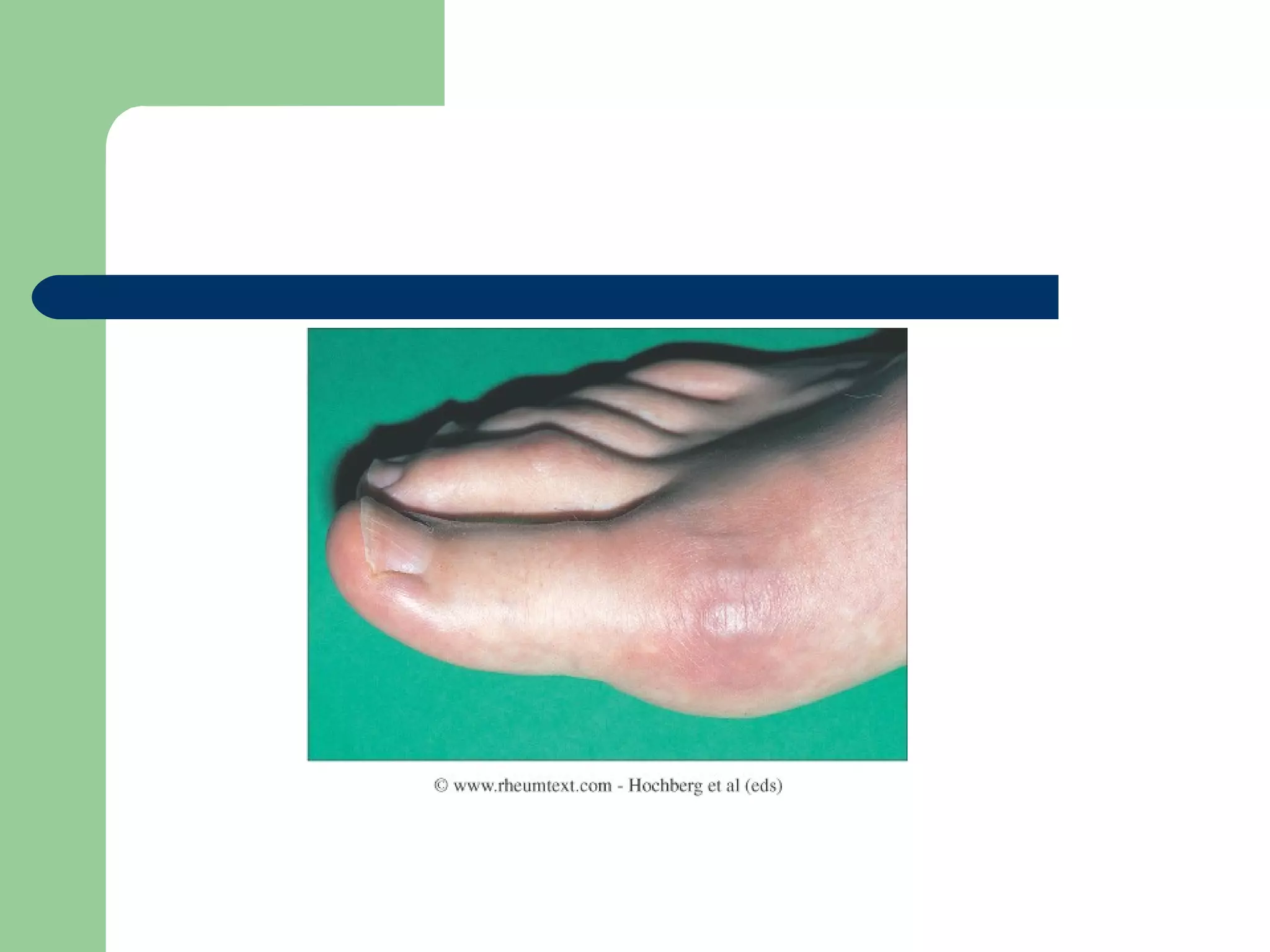 Signs and symptoms in rheumatology | PPT