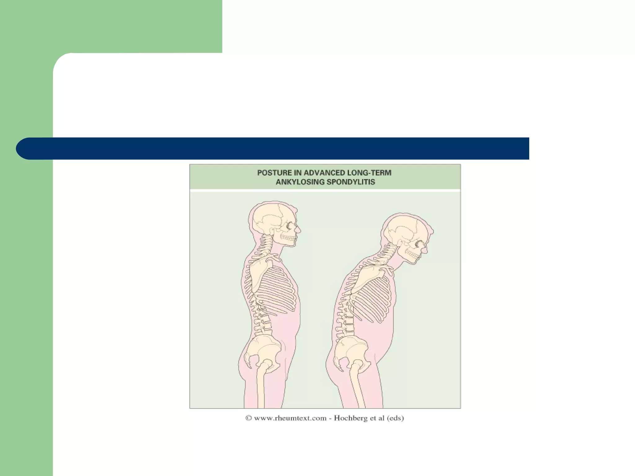 Signs and symptoms in rheumatology | PPT