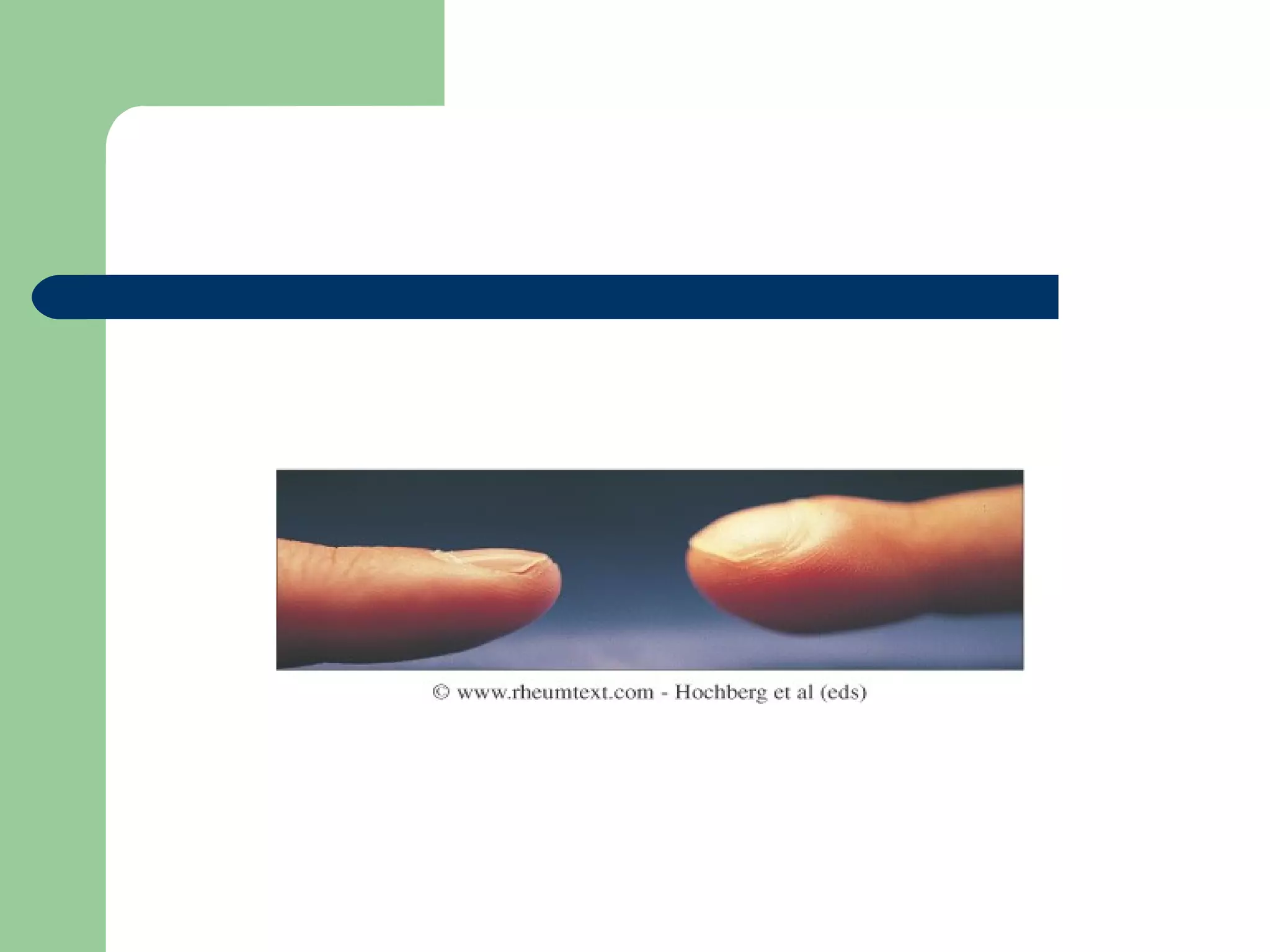 Signs and symptoms in rheumatology | PPT