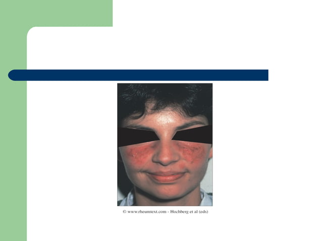 Signs and symptoms in rheumatology | PPT